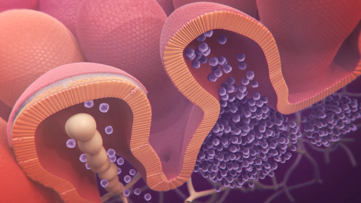 Medical Illustration & Animation - BREAKIRON Animation&Design